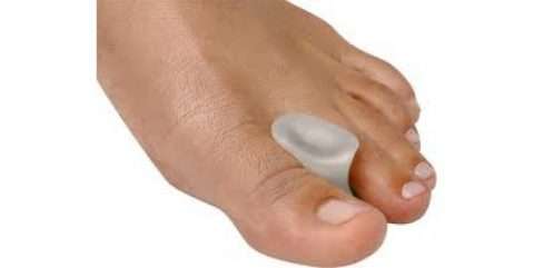 Lesser Toe Deformities | APM